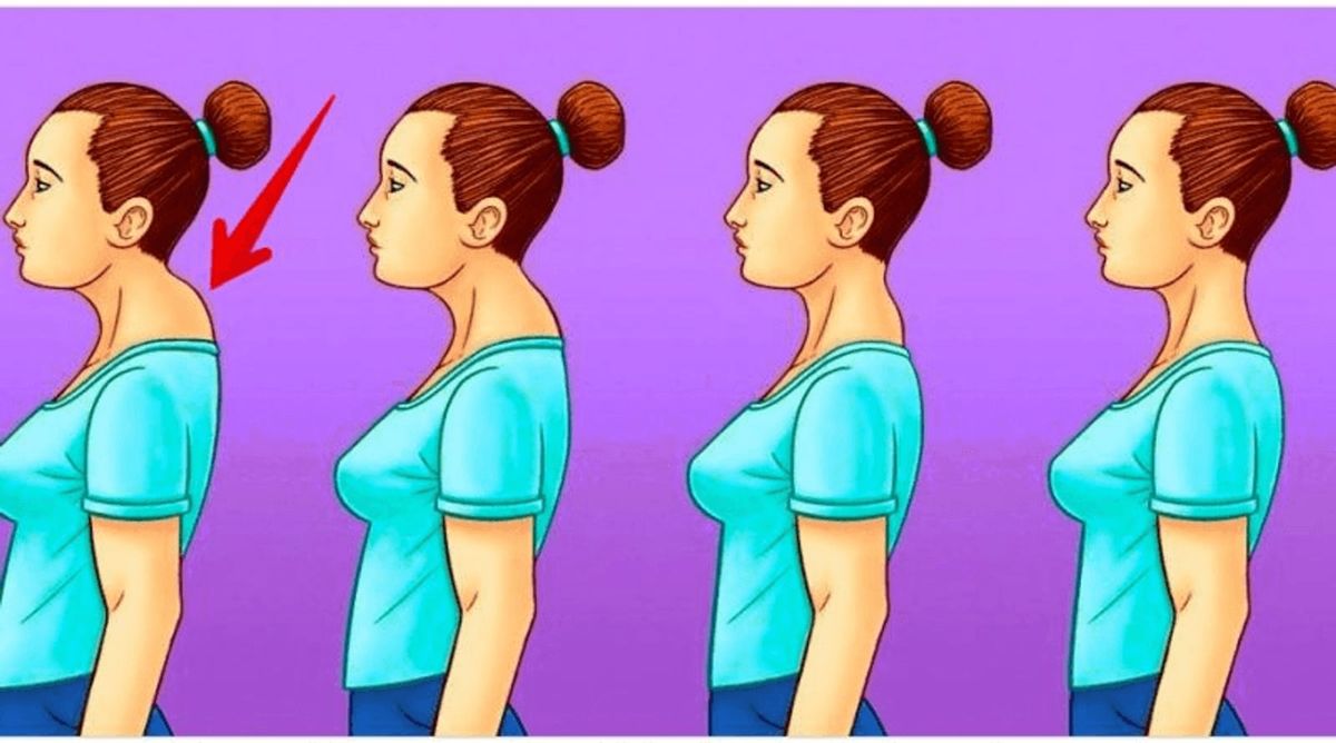 Druskų kuprelės ant kaklo pašalinimo paslaptis: 4 naudingi pratimai, kurių jūs seniai ieškojote